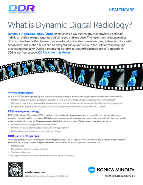 Dynamic Digital Radiography | Konica Minolta Healthcare Americas, Inc.
