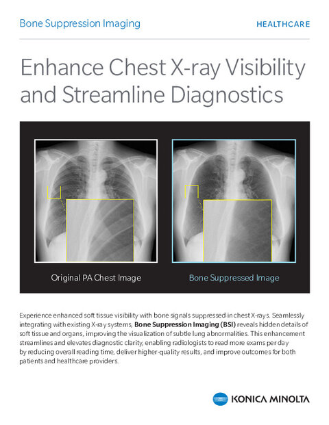 AeroDR Glassless Flat Panel Detectors | Konica Minolta Healthcare ...