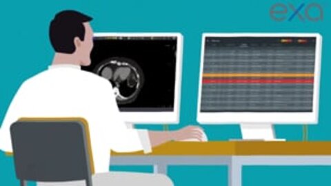 Exa Enterprise | Konica Minolta Healthcare Americas, Inc.