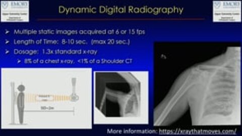 Dynamic Digital Radiography | Konica Minolta Healthcare Americas, Inc.