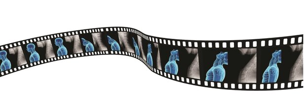 Dynamic Digital Radiography | Konica Minolta Healthcare Americas, Inc.